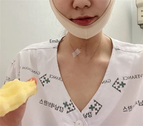 갑상선암 구강 로봇수술 후기 및 수술 후 목상태 변화 강남세브란스 김석모 교수님 네이버 블로그