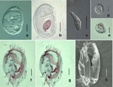 Micrographs Of A Number Of Crawling Ciliated Protozoa Found In The