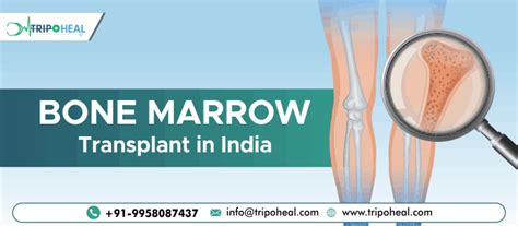 Bone Marrow Transplant In India
