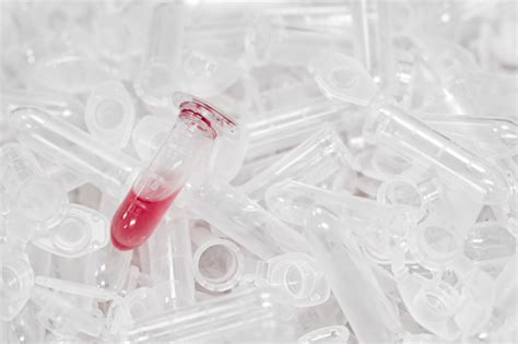 분석 후 적액 또는 혈액을 가진 마이크로 센심 심분리기 Eppendorf 튜브를 사용했습니다 Pcr 테스트 생화학 적 또는 의료