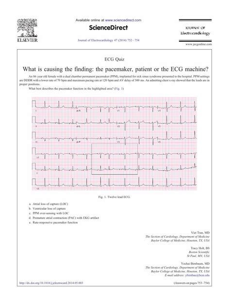 Pdf What Is Causing The Finding The Pacemaker Patient Or The Ecg