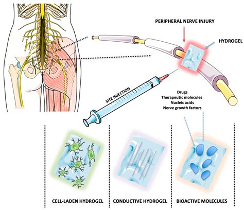 Hydrogels For Peripheral Nerve Repair Emerging Materials And