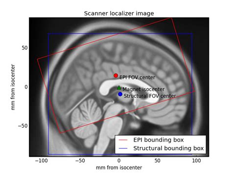 brain imaging png 3d brain images produced from spm showing
