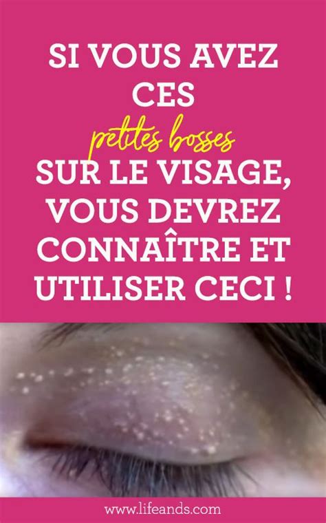Épinglé sur Santé