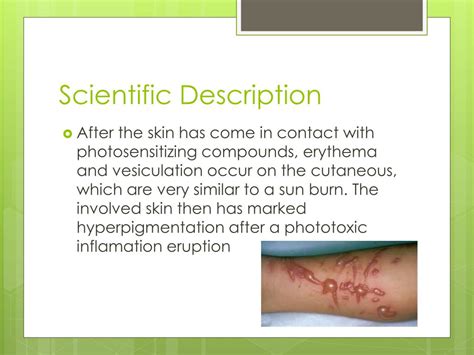 Ppt Phytophotodermatitis Powerpoint Presentation Free Download Id