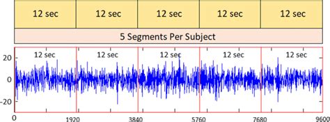 Segmentation Of EEG Data With The Help Of A Non Overlapped Windowing Download Scientific