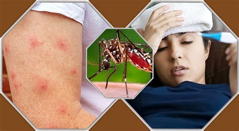 এডিস মশা কখন কামড়ায় চিনবেন কীভাবে