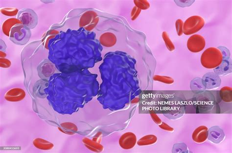 Follicular Lymphoma Cells Illustration High Res Vector Graphic Getty