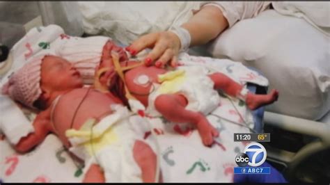 Rare Twins Born Holding Hands On Mothers Day In Ohio Abc7 Los Angeles