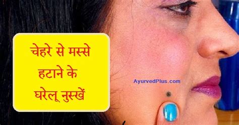 चेहरे से मस्से हटाने के घरेलू नुस्खें आयुर्वेदप्लस