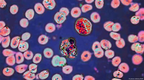 Another Mystery Disease Outbreak In Dr Congo What We Know