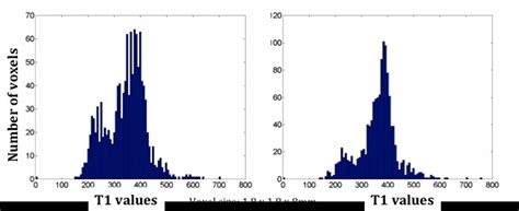 Motion Correction Using Hierarchical Local Affine Registration Improves