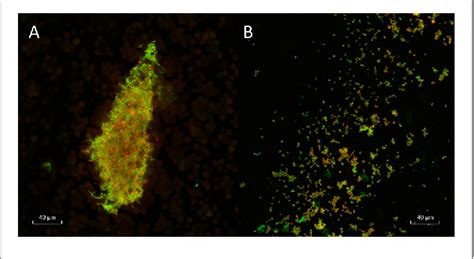 Figure 1 From Alloiococcus Otitidis Forms Multispecies Biofilm With