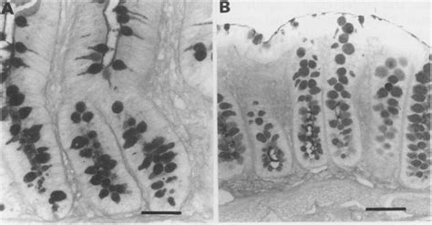 Mucosal Epithelium Of A Small Intestine And B Large Intestinal