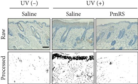 Immunohistochemical Analysis Of Ultraviolet UV Irradiated Skin
