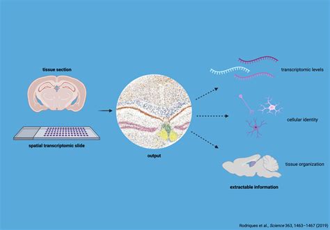 Dissecting Cancer Complexity Across Space And Time