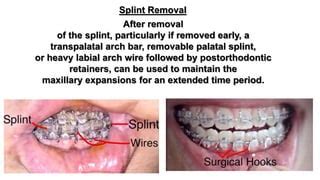 Postsurgical Orthodontics Pptx