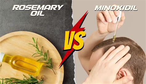 Guide Rosemary Oil Vs Minoxidil Top 5 Trichologist Finder