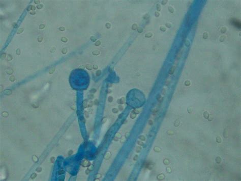 Mucor Sp