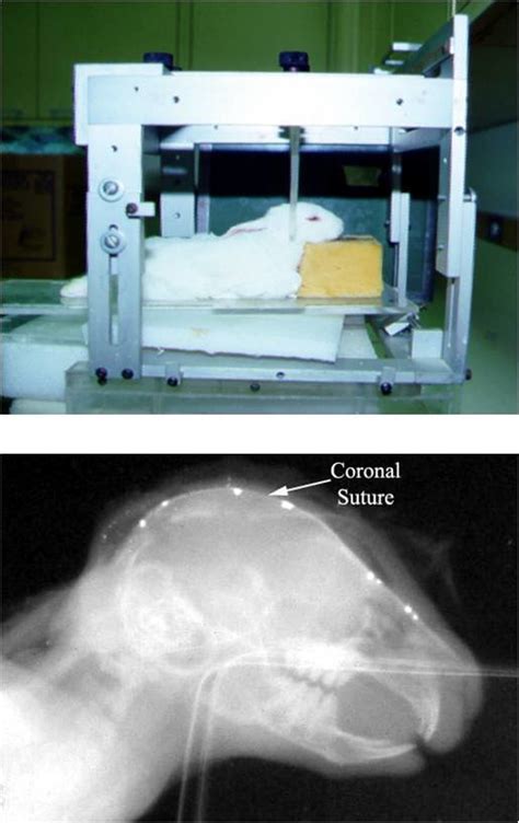 Cephalostat And 25 Day Radiograph With Amalgam Markers Provided By Dr