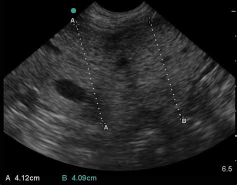 Prostaatproblemen Bij De Hond Een Veel Voorkomend Probleem Bij Oudere