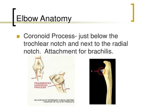 Ppt Elbow Joint Powerpoint Presentation Id645385