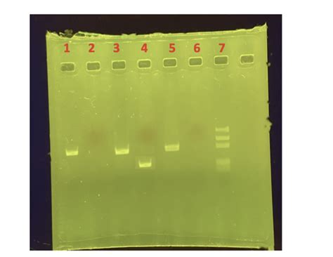 Your Spreadsheet Should Include Your DNA Marker Chegg