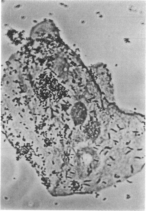Figure Phase Contrast Micrographs Ofgenital Epithelial Cells Volunteer