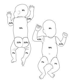 CFD Term Final Flashcards Quizlet