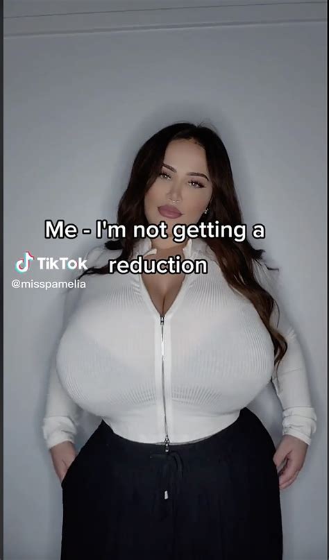 My Boobs Wont Stop Growing — I Have A Rare Condition
