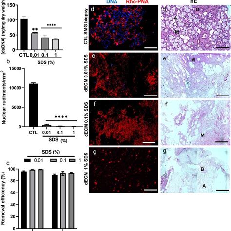 After Decellularization With 0 1 And 1 Sds Perfusion Treatments