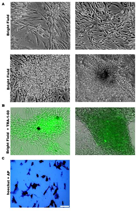 131 Generation Of Ipsc Cells From Human Skin Fibroblast With Osklmn Download Scientific