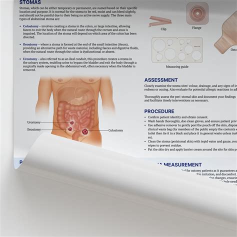Stoma Care Chart Ostomy Assessment Poster Anatomystuff Stoma Care Chart Ostomy Assessment Poster Anatomystuff