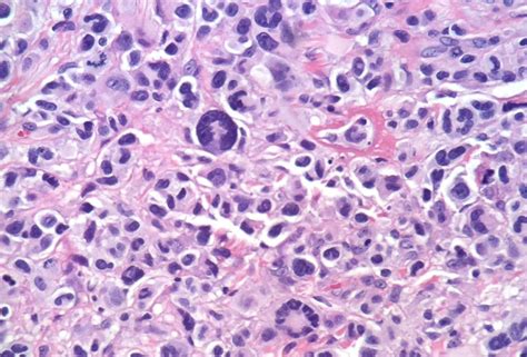 Cerebriform Nuclei