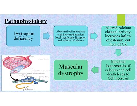 Muscular Dystrophy Ppt Pdf Pdf