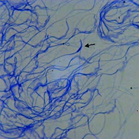 Gram Staining Of Sperm Cells To Reveal Chromatin Condensation Status Download Scientific