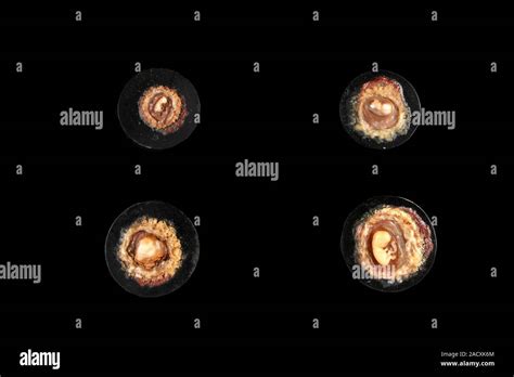 Wax Anatomical Models Of A Human Embryo Development In The Uterus The