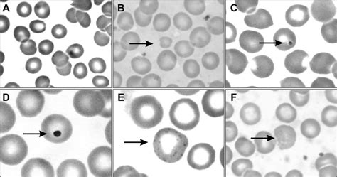 5 Observaciones Microscópicas De Eritrocitos Humanos 100x