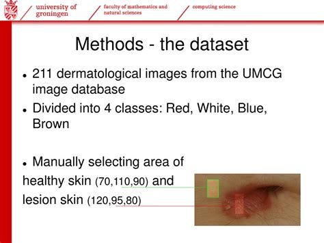 Ppt Content Based Image Retrieval Cbir Of Dermatological Images Powerpoint Presentation Id