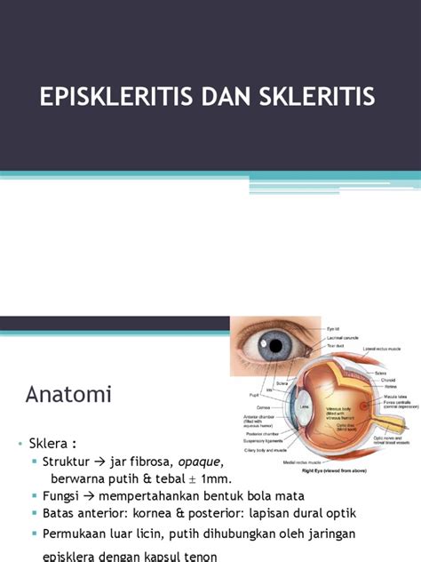 Episkleritis Dan Skleritis Gejala And Pengobatan Pdf