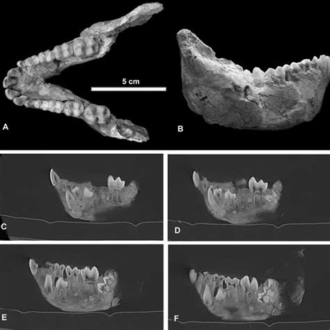 Complete Mandible Ampg Po 114 F Of A Juvenile Male Of Download