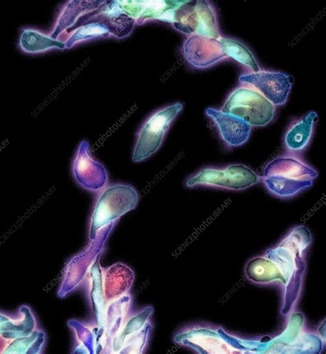Mycoplasma Genitalium Bacteria Tem Stock Image C045 5926 Science