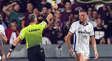 Son Dakika Haberi Merih Demiral Korkuttu Devam Edemedi Futbol