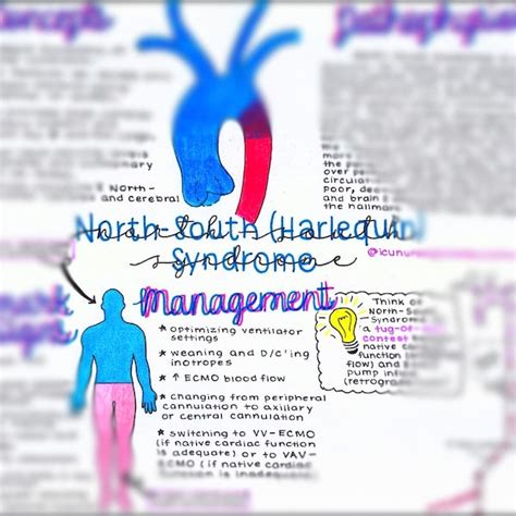 North South Syndrome Etsy