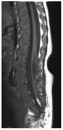 Congenital Malformations Radiology Key