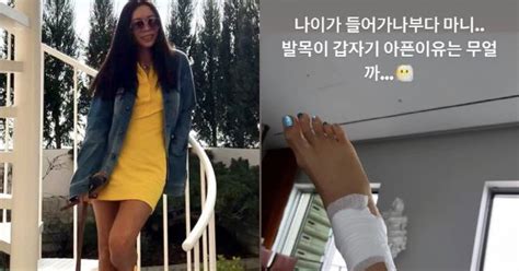 “아파요” 이혜영 명품 각선미인데12억 보험든 다리에 무슨 일이