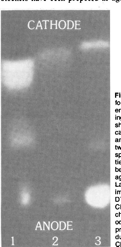 Figure 1 From The Neurologic Sequelae Of Cardiac Arrest Semantic Scholar