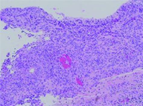 Microscopic Examination Hande At High Power Showing Spindle Cell Download Scientific Diagram