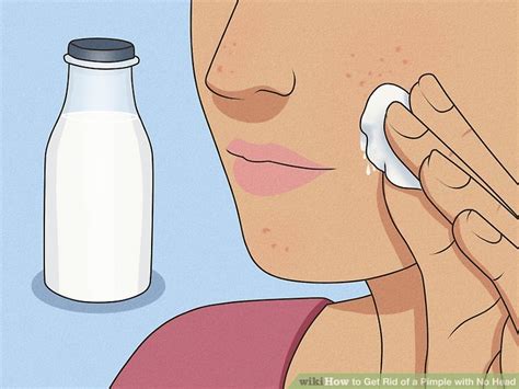 Ways To Get Rid Of A Pimple With No Head WikiHow Ways To Get Rid Of A Pimple With No Head WikiHow