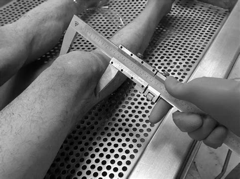 Measurement Of The Maximum Proximal Width Of The Tibia Download